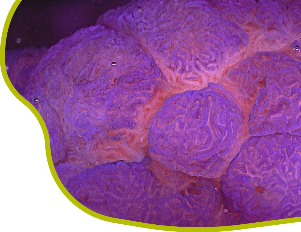 Basic - The Training in optical diagnosis of early CRC platform